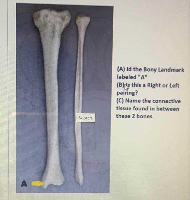 Solved (A) Id the Bony Landmark labeled " A " (B) Ns this a | Chegg.com