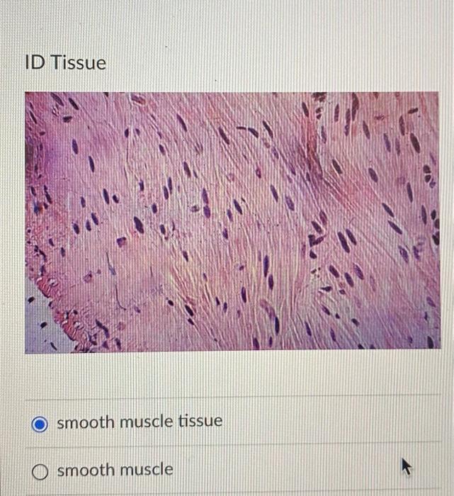 ID Tissue smooth muscle tissue smooth muscle | Chegg.com