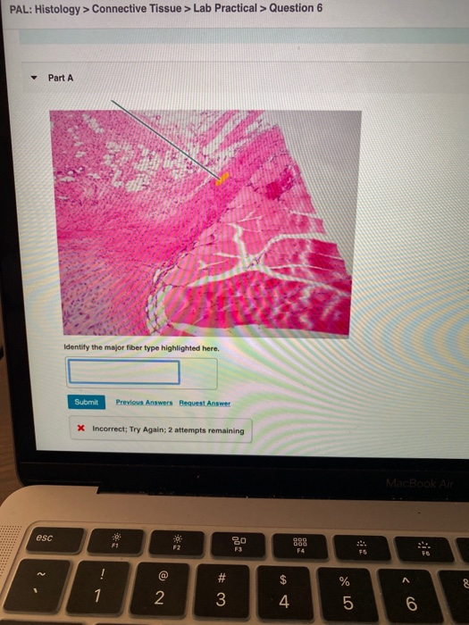 Solved PAL: Histology > Connective Tissue > Lab Practical > | Chegg.com