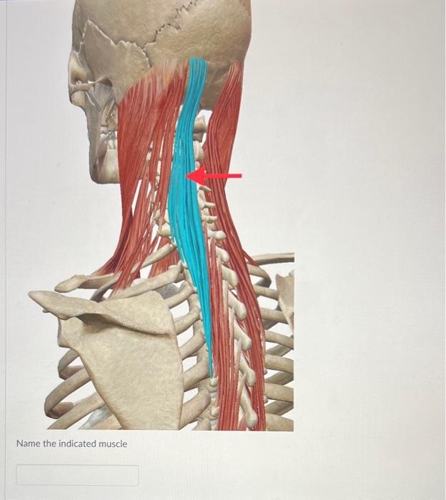 Solved Name the indicated muscle Name the indicated | Chegg.com