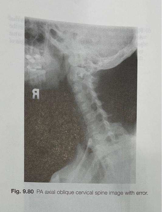 Solved 5. Fig. 9.80 shows a PA axial oblique projection | Chegg.com