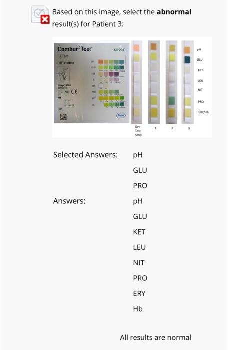 Solved Based on this image, select the abnormal result(s) | Chegg.com