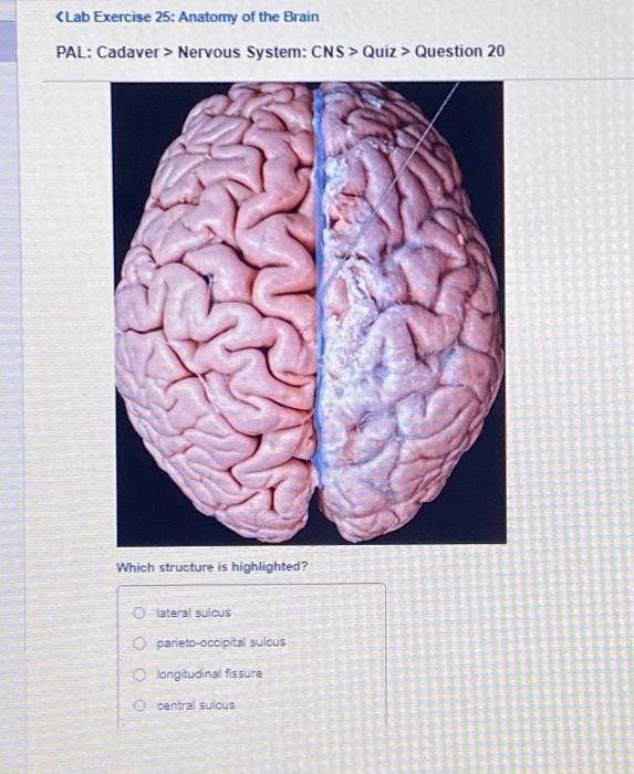 Solved Nervous System: CNS > Quiz > Question 19 Which | Chegg.com