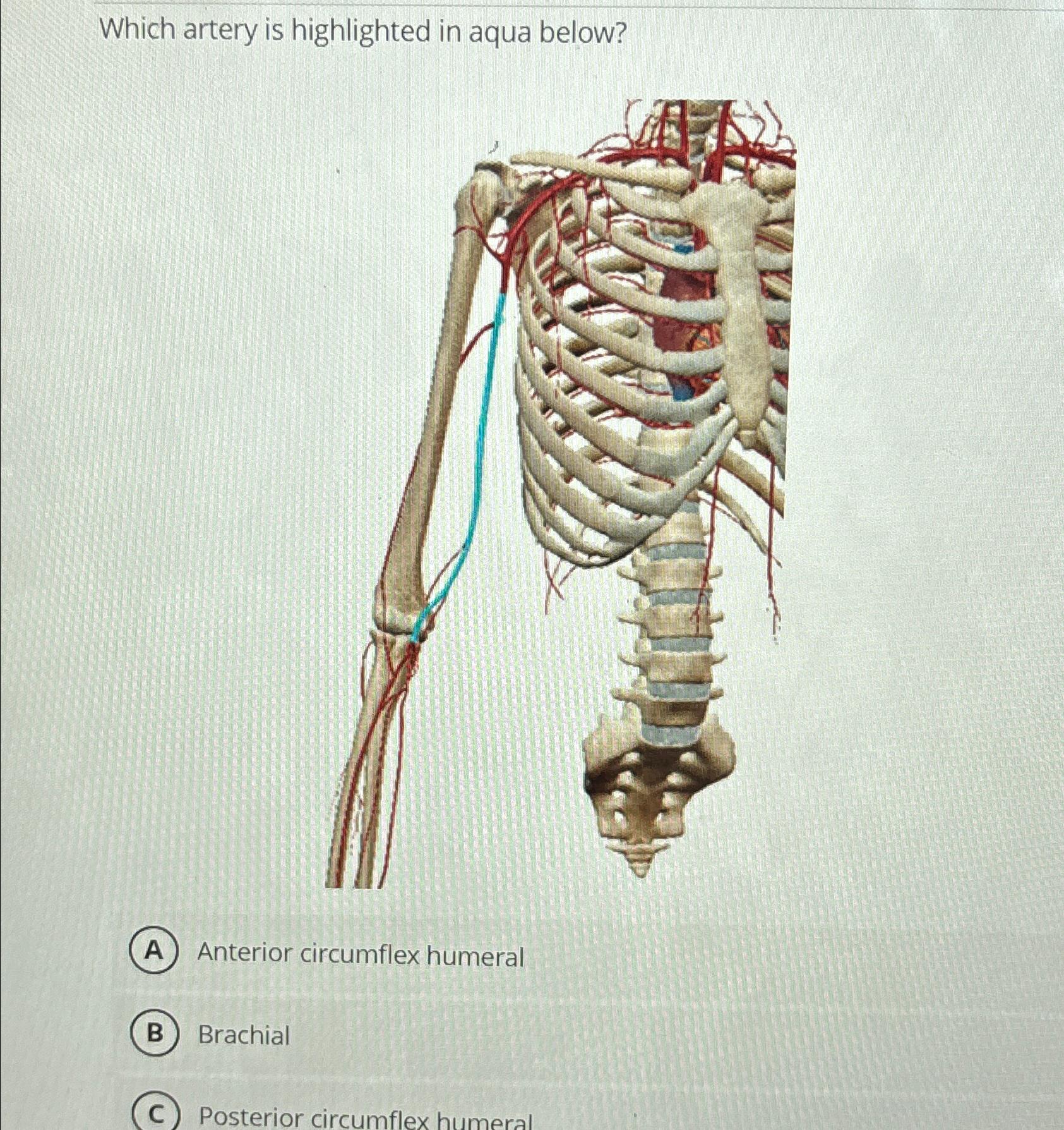 Solved Which artery is highlighted in aqua below?Anterior | Chegg.com
