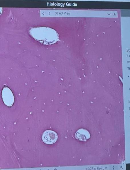 Solved name and label the nucleus , type of bone/cartilage , | Chegg.com Solved name and label the nucleus , type of bone/cartilage , | Chegg.com