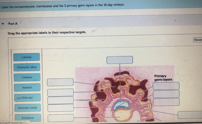 Solved Label the extraembryonic membranes and the 3 primary | Chegg.com