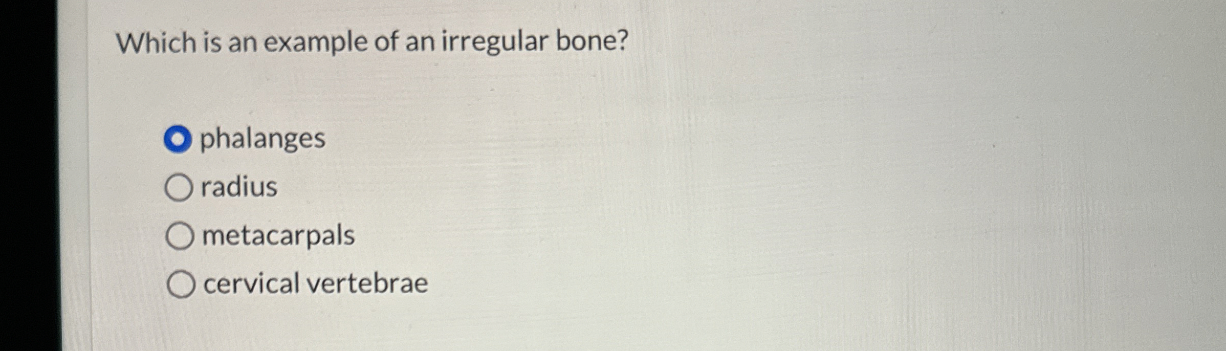 Solved Which is an example of an irregular | Chegg.com