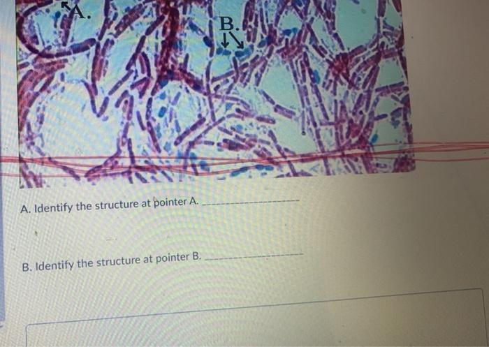 Solved B. A. Identify the structure at pointer A. B. | Chegg.com