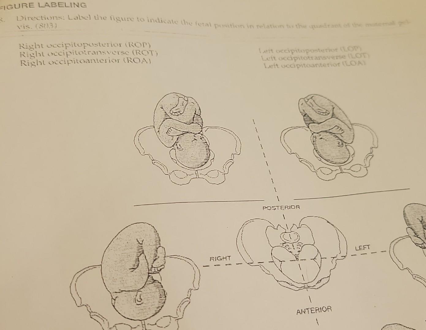 Solved 8. Directions: Label the figure to indicate the fetal | Chegg.com