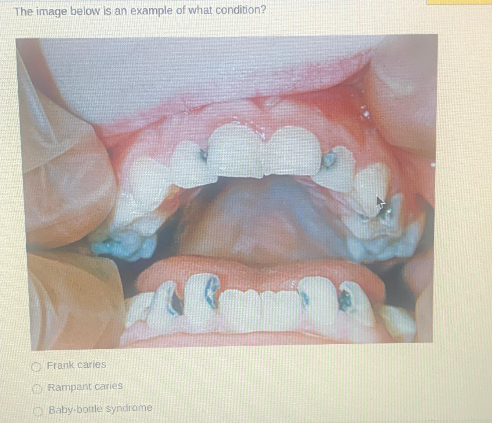 Solved The image below is an example of what condition?Frank | Chegg.com