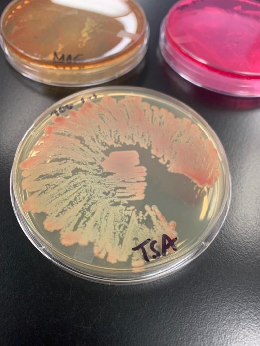 Solved TSA CE MAC ng 1/2 100% + MSA Growth (Gram) PRIMARY | Chegg.com