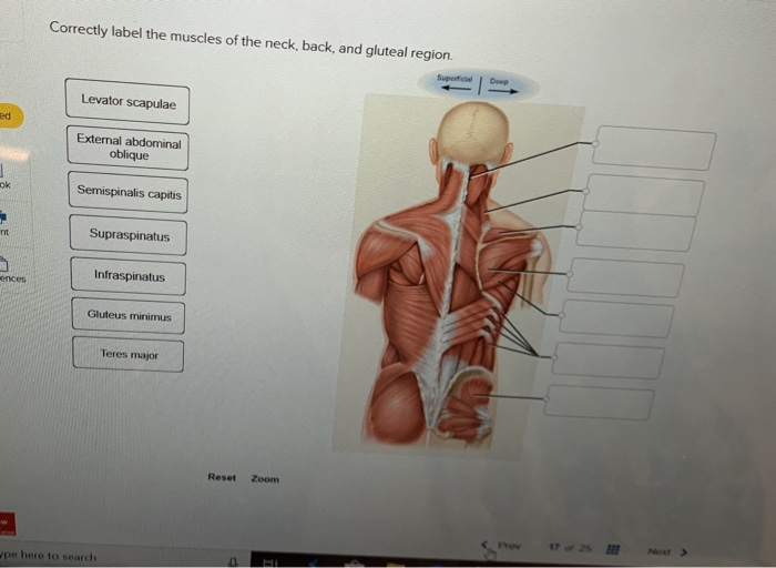 Solved Correctly label the muscles of the neck, back, and | Chegg.com