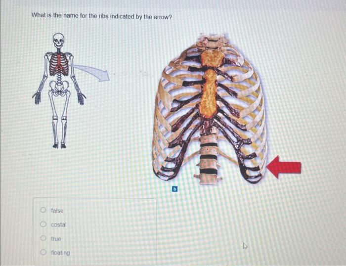 Solved What is the name for the ribs indicated by the arrow? | Chegg.com