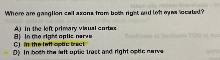 Solved Where are ganglion cell axons from both right and | Chegg.com