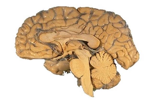 Solved Identify the structures of the brain | Chegg.com