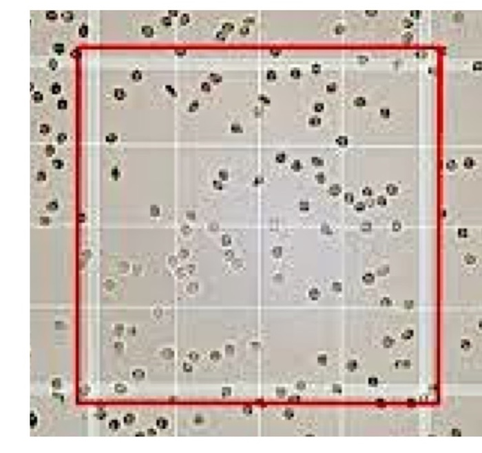 Solved Calculate the total RBC number manually in one of the | Chegg.com