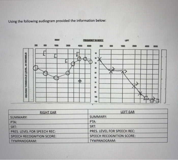 Using the following audiogram provided the | Chegg.com