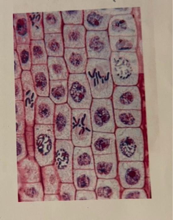 Solved LABEL EACH CELL AS EITHER INTERPHASE, PROPHASE, | Chegg.com
