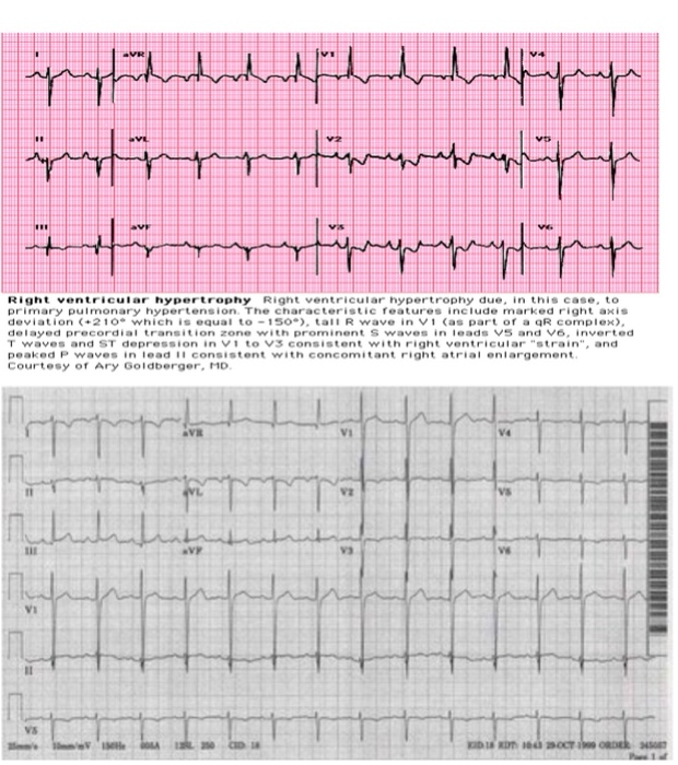 Solved 1. What is the underlying rhythm 2. Determine the | Chegg.com