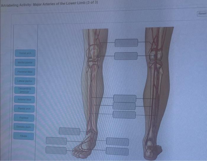 Solved Art-fabeling Aclivity: Major Arteries of the Lower | Chegg.com