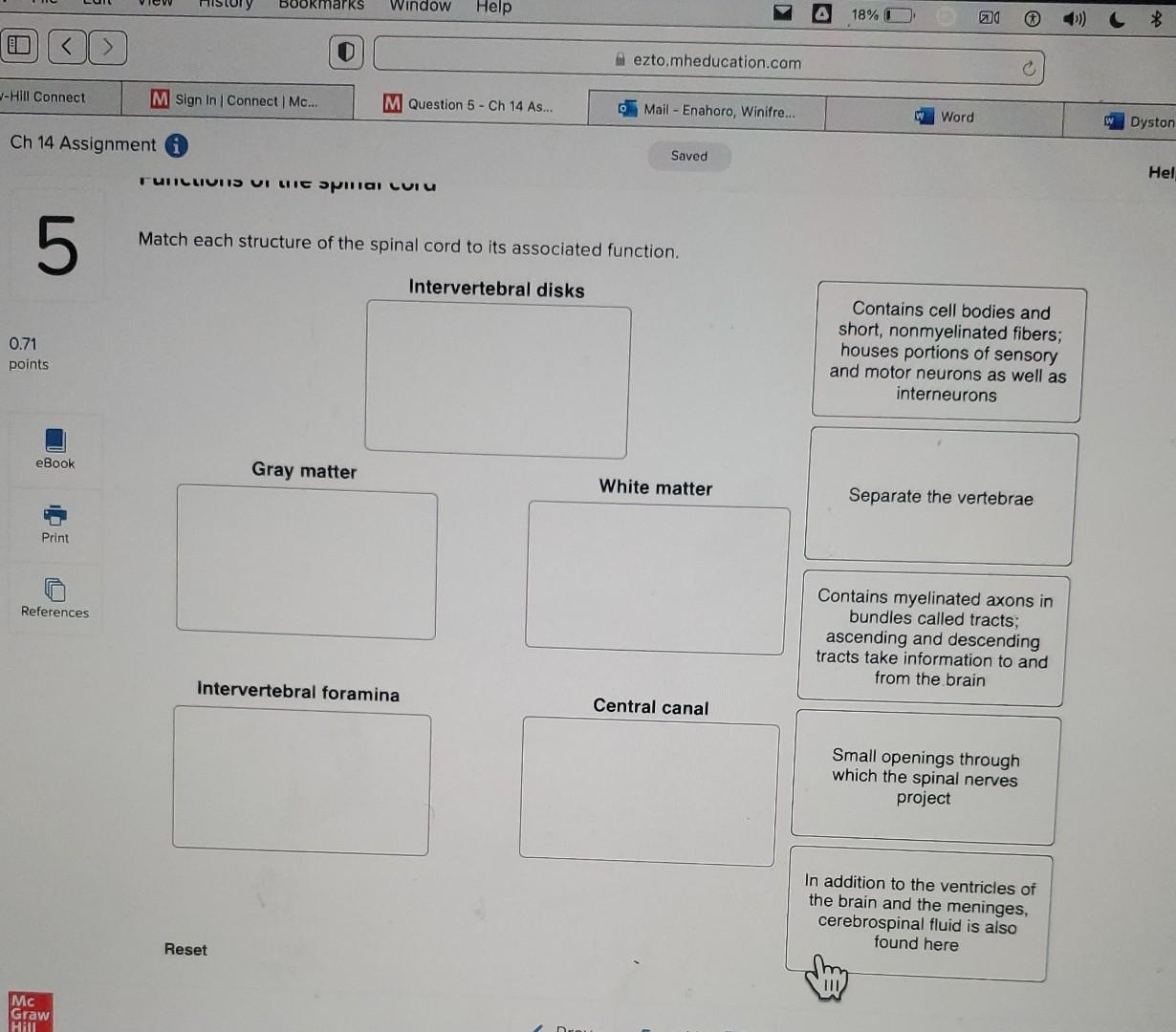 Match each structure of the spinal cord to its | Chegg.com