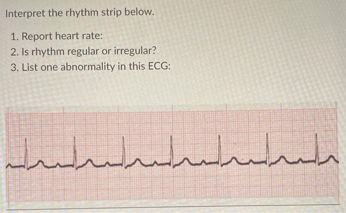 Solved Interpret the rhythm strip below. 1. Report heart | Chegg.com