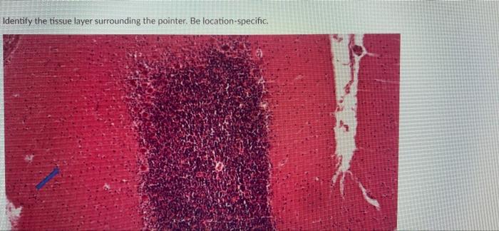 Identify the tissue layer surrounding the pointer. Be | Chegg.com