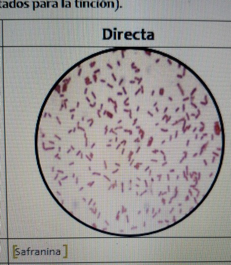 Solved direct staining with safranin find a similar bacteria | Chegg.com