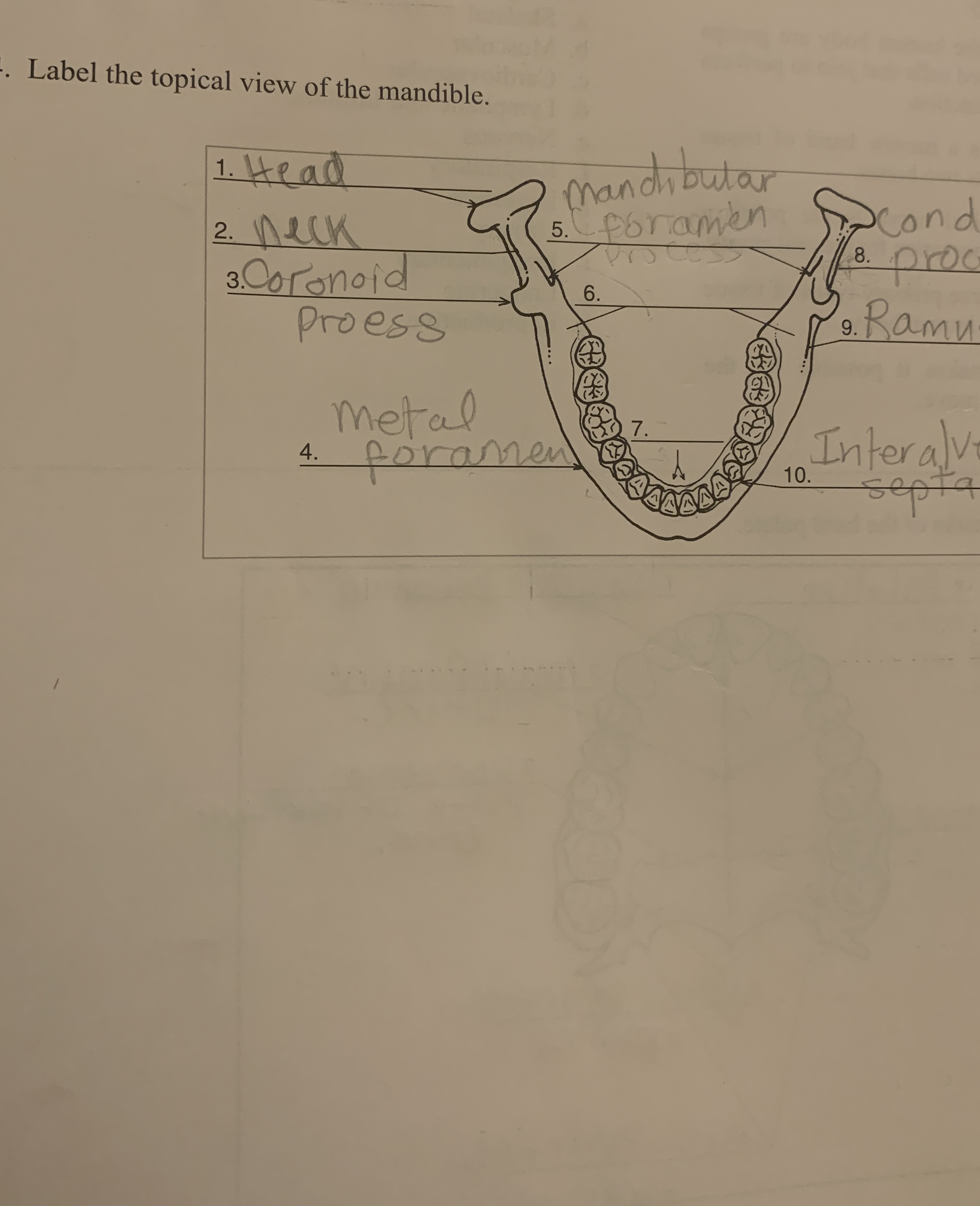 Solved Label the topical view of the mandible correctly. Im | Chegg.com