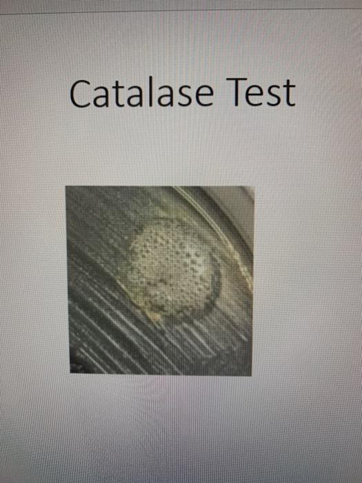 Solved Gram Stain Catalase Test Cytochrome Oxidase | Chegg.com