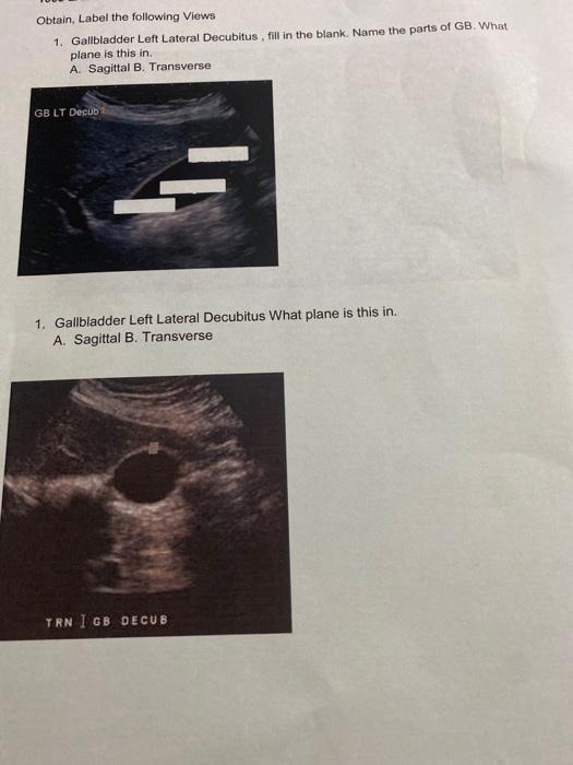 Solved Obtain, Label the following Views 1. Gallbladder Left | Chegg ...