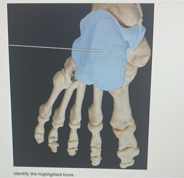 Solved Identify the highlighted bone. Identify the | Chegg.com