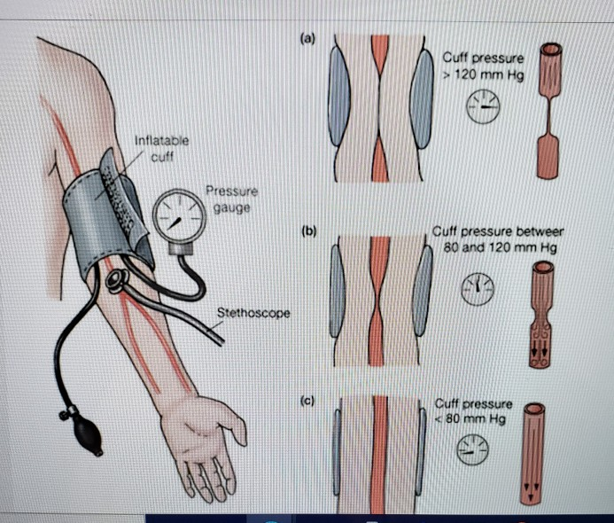 (a) Cuff pressure > 120 mm Hg Inflatable cuff | Chegg.com