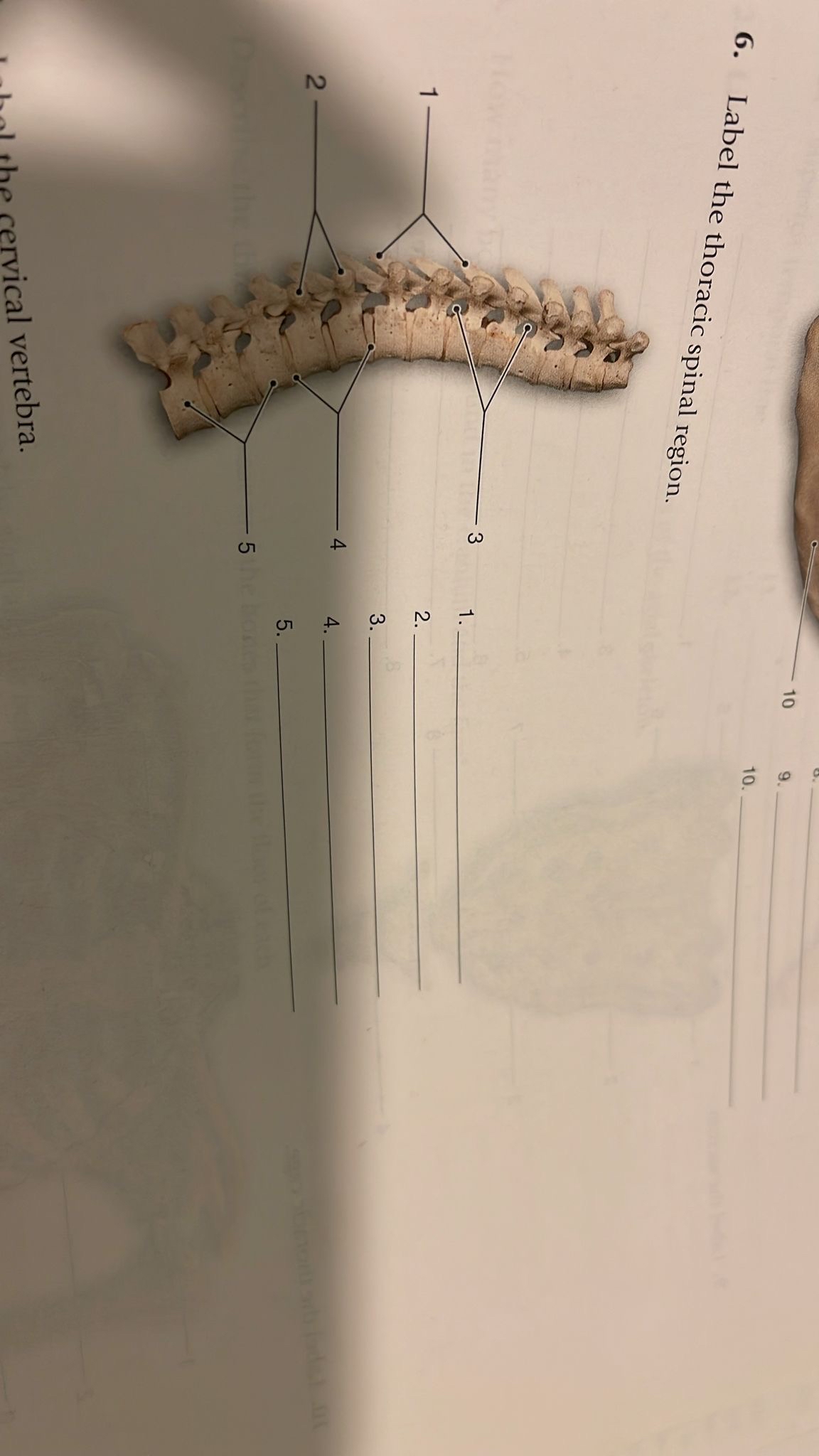 Solved Label the thoracic spinal region10 | Chegg.com