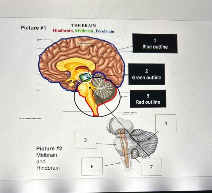 Picture \#1 THE BRAIN Hindbrain, Midbrain, | Chegg.com