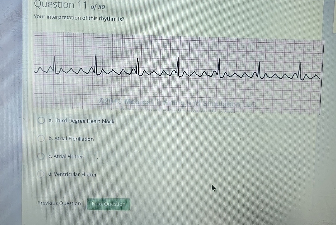 Solved Question 11 ﻿of 50Your interpretation of this rhythm | Chegg.com