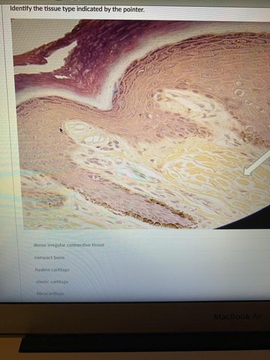 Solved Identify the tissue type indicated by the pointer. | Chegg.com