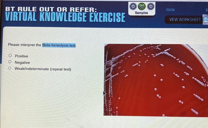 Solved BT RULE OUT OR REFER: VIRTUAL KNOWLEDGE EXERCISE | Chegg.com