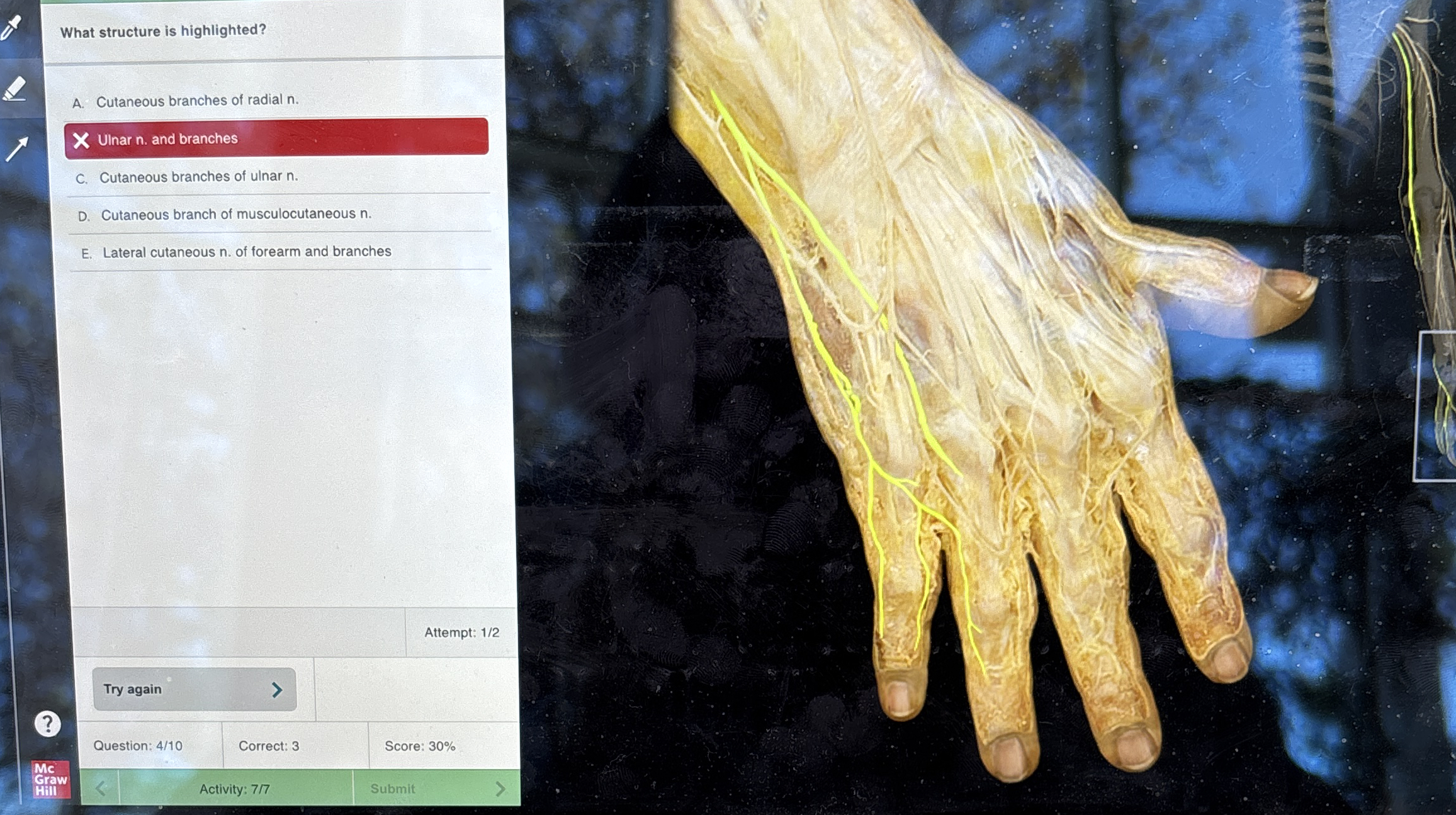 Solved What structure is highlighted?A. ﻿Cutaneous branches | Chegg.com