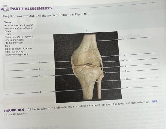 Solved Using the terms provided, label the struetures | Chegg.com