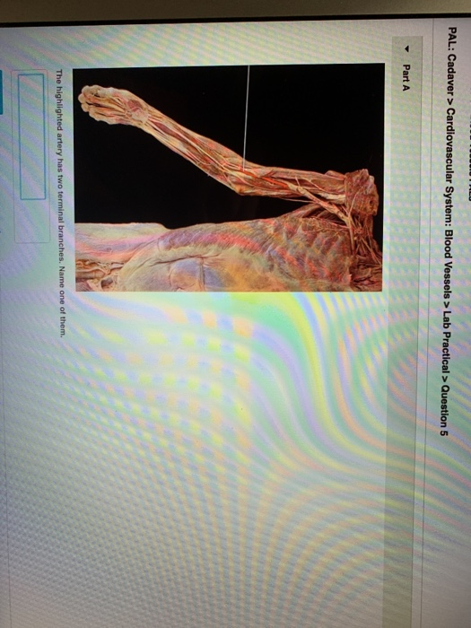Solved PAL: Cadaver > Cardiovascular System: Blood Vessels > | Chegg.com