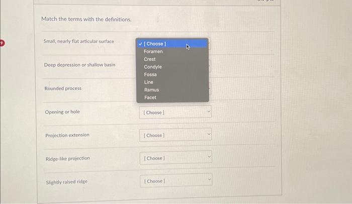 Solved Match the terms with the definitions. Small, nearly | Chegg.com