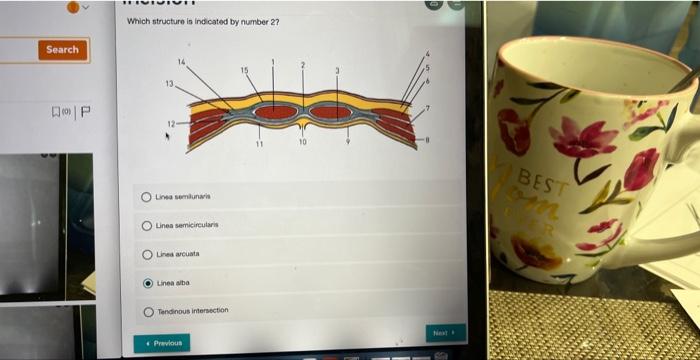 Solved Midline Abdominal Wall Incision 1 2 (3) 5 Fusion of | Chegg.com