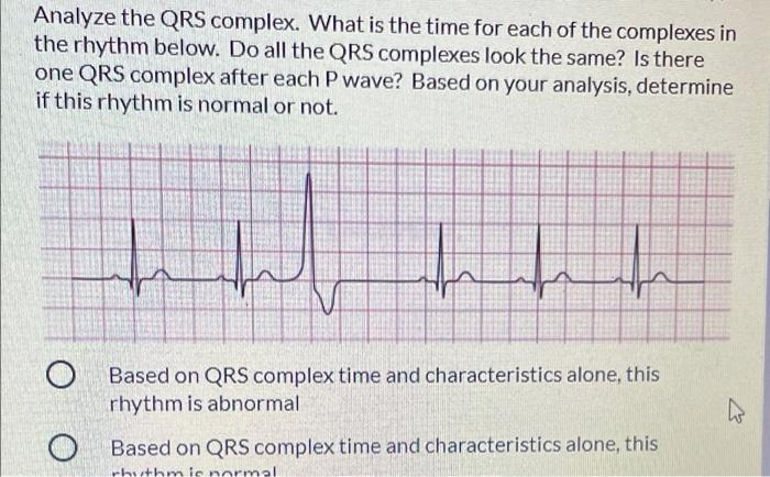 Solved Step 5: Analyze the QRS complex The QRS complex time | Chegg.com