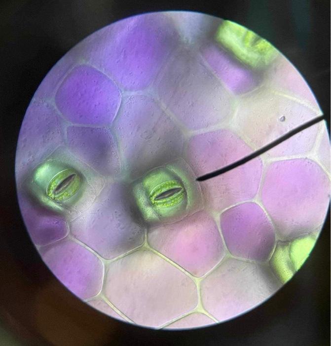 Label the parts of the vacuole (plant cell)a) what | Chegg.com