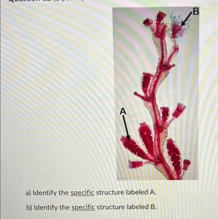 Solved B A a) Identify the specific structure labeled A. b) | Chegg.com