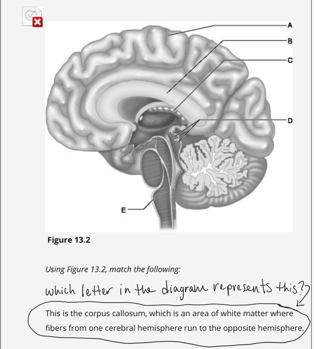 Corpus Callosum Diagram