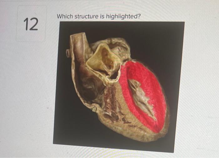 Solved Which structure is highlighted? Multiple Choice | Chegg.com