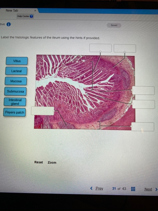 Solved New Tab Help Center? tive Seved Label the histologic | Chegg.com
