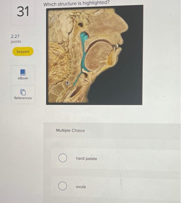 Solved Which structure is highlighted? 35 2.27 points | Chegg.com
